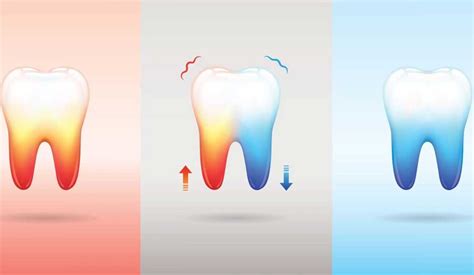Are You Getting Zinged By Hot Or Cold You Could Have Tooth Sensitivity