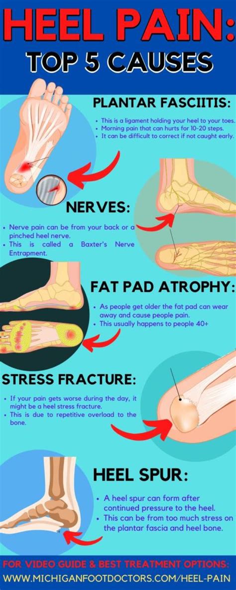 Plantar Fasciitis Related Nerve Entrapment Plantar People