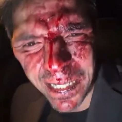 Familiares De César Dalessio Temerían Por Su Estado De Salud Infobae