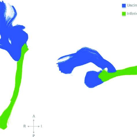 Diffusion Tensor Imaging Tractography Of The Uncinate Fasciculus Blue