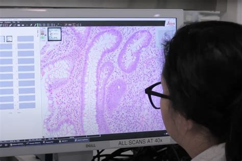 Anatomic Pathology Lab Services Acelabio