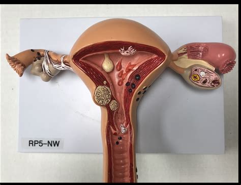 Female Reproductive System Part 1 Diagram Quizlet