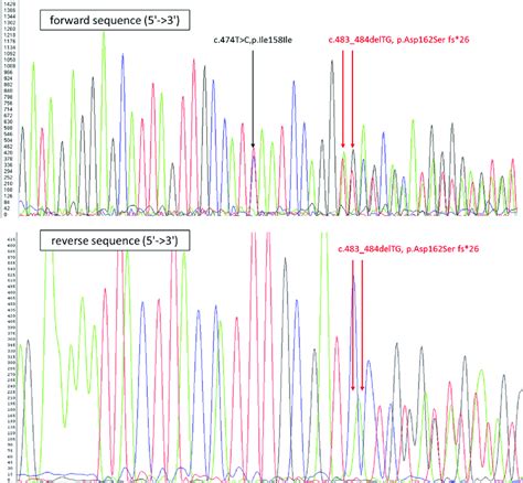 Electropherogram Obtained With The Seqscape V25v Software Applied