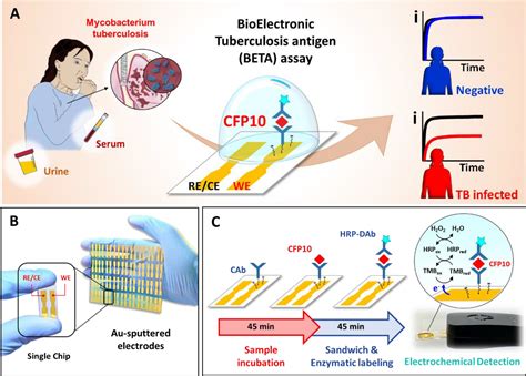 Mycobact Tb Pcrurine Krown Laboratory And Referral Center