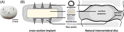 A Biomimetic Artificial Intervertebral Disc Bioaid B Schematic