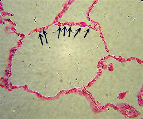 Simple Squamous Epithelium Slide Lung