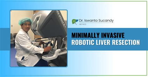 Minimally Invasive Robotic Liver Resection Iswanto Sucandy Md