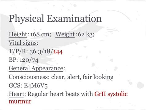Case Report Atrial Flutter