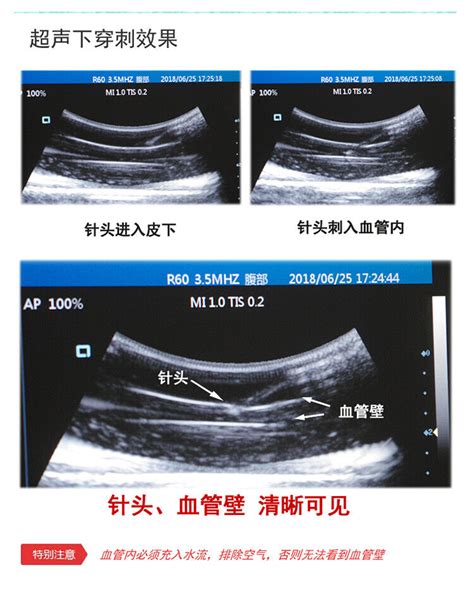 Ultrasound Guided Vascular Puncture Model Puncture Ubuy India
