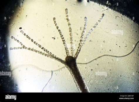 Hydra Under Microscope
