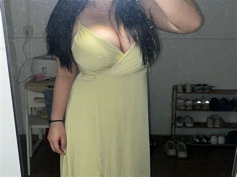 19歲少女注射新冠疫苗引發巨乳症 胸部在半年內增大4倍 Lihkg 討論區