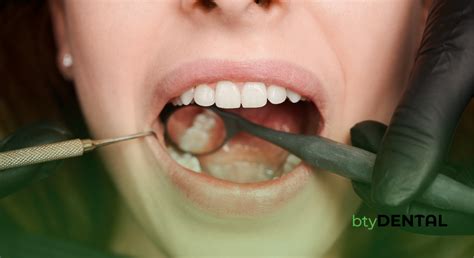 Simple Or Surgical Wisdom Tooth Extraction In Lynnwood