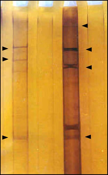 Electroforesis De Arn De Doble Cadena En Gel De Poliacrilamida 6