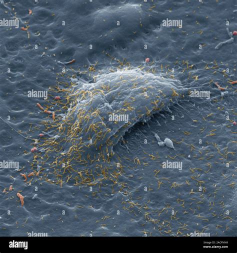 Contaminated Cell In Culture Coloured Scanning Electron Micrograph Sem Of Bacteria Yellow