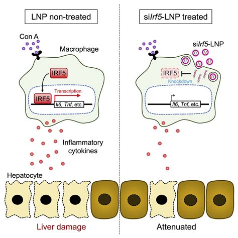 Irf5 Sirna Loaded Biodegradable Lipid Nanoparticles Ameliorate