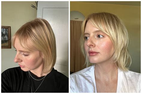 I Got Prp Injections For Hair Loss See Photos Popsugar Beauty