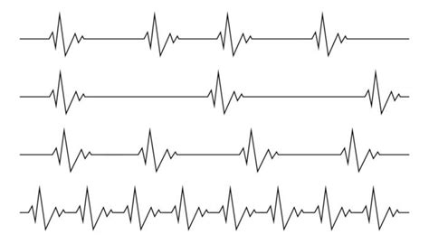 Ecg Results Vector Art Icons And Graphics For Free Download