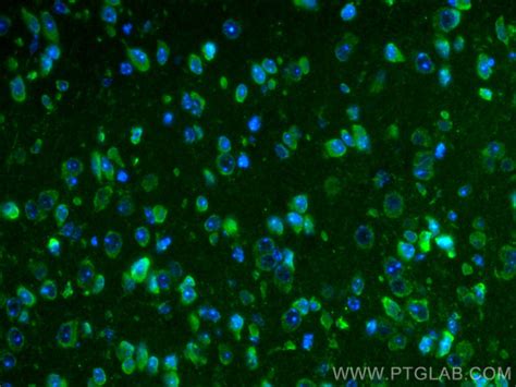 Slc38a9 Polyclonal Antibody 21871 1 Ap
