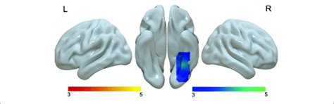 Brain Activation In The Main Effect Of Age Brain Regions That Were