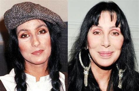 Top 10 Celebrities Who Have Had Plastic Surgery Gone Wrong Plastic