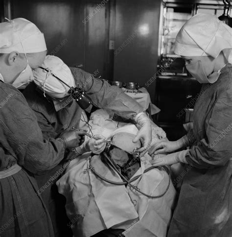 Lobotomy Surgery 1949 Stock Image C0584785 Science Photo Library