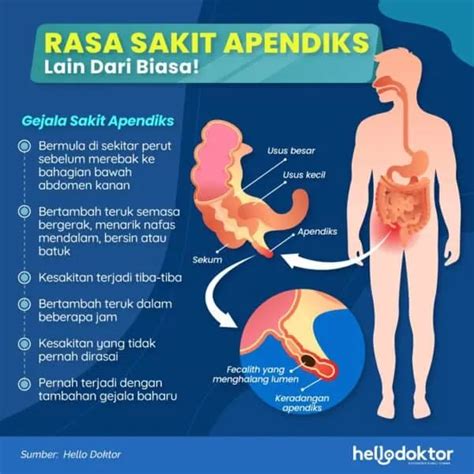 Punca Apendiks Adakah Biji Cili Salah Satu Daripadanya Hello Doktor