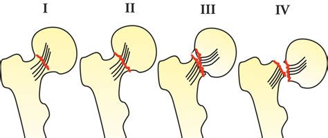 Gardens Classification Wikilectures