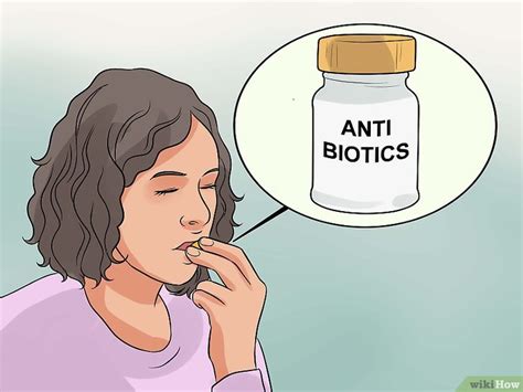 Candida Behandelen 15 Stappen Met Afbeeldingen Wikihow