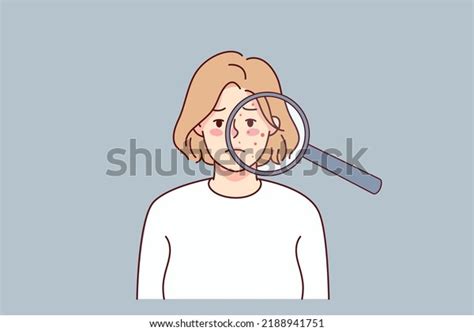 1863 Acne Scars On Face Stock Vectors And Vector Art Shutterstock