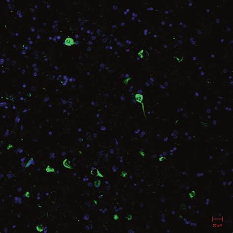 1 Hyperphosphorylated Tau Formed Tangles In The Ad Human Brain Human Download Scientific