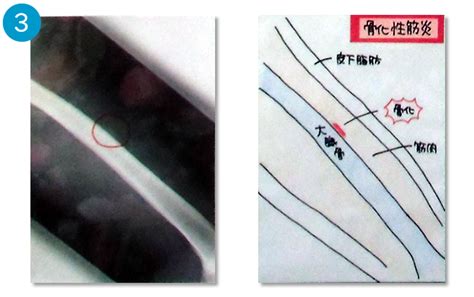 健康通信Vol 13 大道整形外科 整形外科 リハビリテーション科 リウマチ科