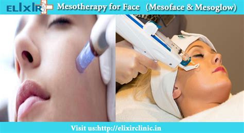 Dr Abdul Aziz Rafi Ahmed On Linkedin Mesotherapy Is Cosmetic Skin