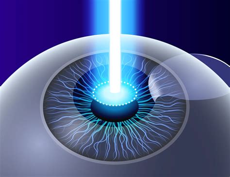 Apakah Lasik Bisa Pakai Bpjs Ini Penjelasan Sistemnya Jec Eye