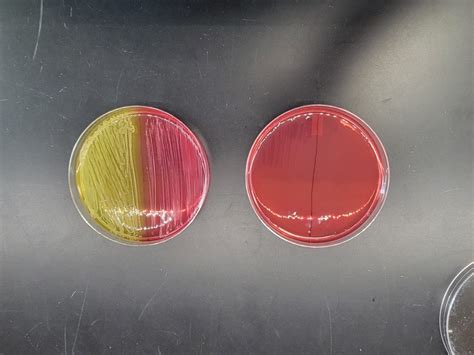 Mannitol Salt Agar Slant