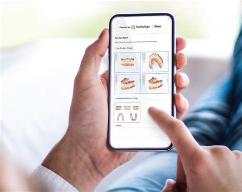 Restorative Treatments Itero