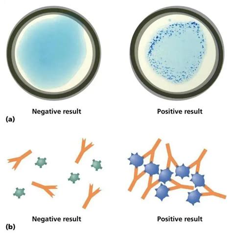 Serological Reactions Types Uses Medicine