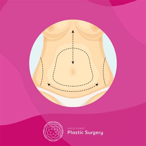 Body Surgery Gold Coast And Brisbane Plastic Surgery