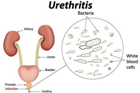 ท่อปัสสาวะ