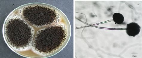 Aspergillus Sp A Colonial Appearance 7 Days Light Microscopic