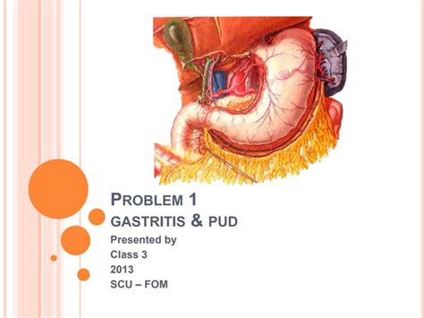 Peptic Ulcer Disease Ppt