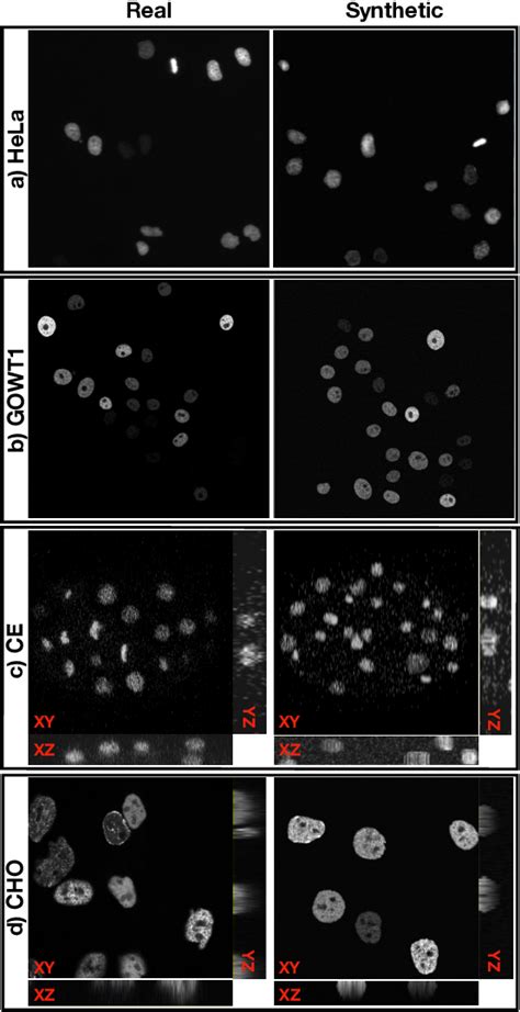 Cascaded Diffusion Models For 2d And 3d Microscopy Image Synthesis To