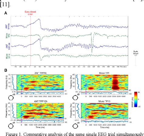 Figure From EEG Based Brain Computer Interface For Alpha Speed Control Of A Small Robot Using