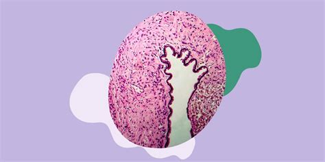 What Does A Cyst Look Like On Vag At Dara Patao Blog