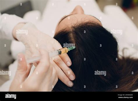 Cosmetic Scalp Injection Stock Photo Alamy