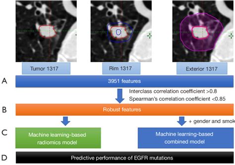 Study Design A Radiomic Features Were Extracted From The Preoperative