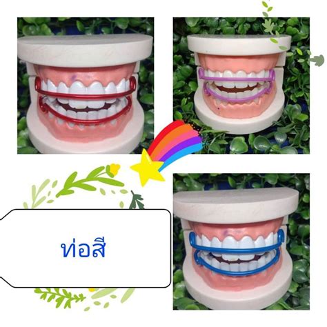 รีเทนเนอร์ไร้เหงือกท่อสีเลือกสีได้เลย พร้อมส่ง Shopee Thailand