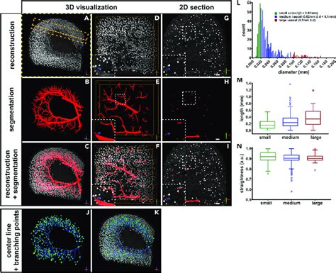 Hierarchical Random Walker Segmentation Of A Subvolume Of The Renal