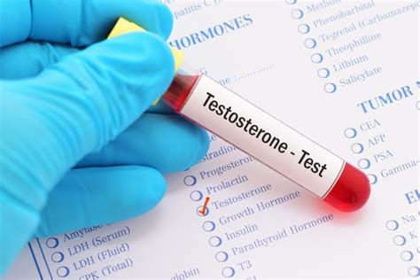 How To Get Prescription For Testosterone Therapy Online