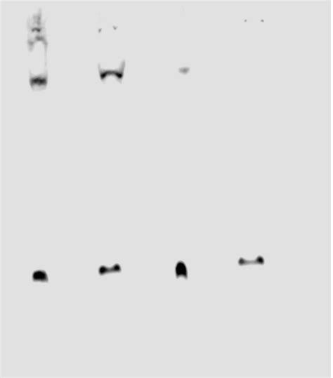 Cell Lysis Buffer Recipe Western Blot Besto Blog