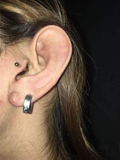 Piercing Bump Or Keloid R Legitpiercing